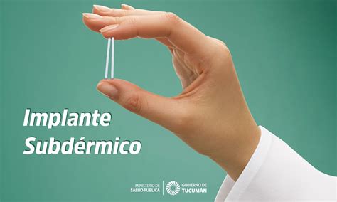 Implante Subdérmico Cómo Funciona Y Quiénes Pueden Colocárselo