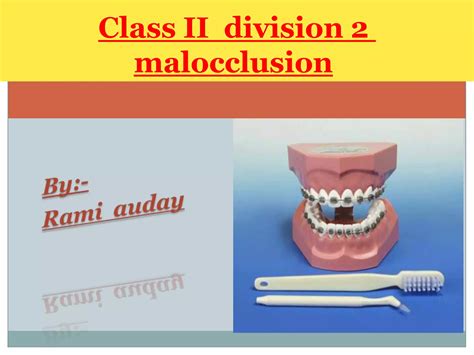 Class Ii Division 2 Malocclusion Pptx Dental Health Diseases And Conditions
