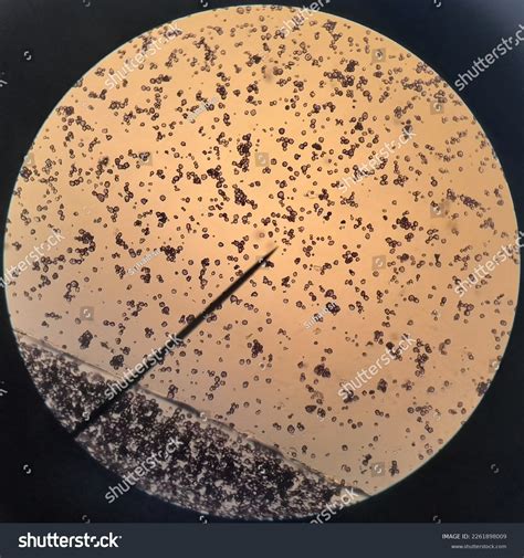 Maize Starch Granules Under Light Microscope Stock Photo Shutterstock
