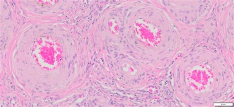 Human Ovary Normal Ffpe Sections