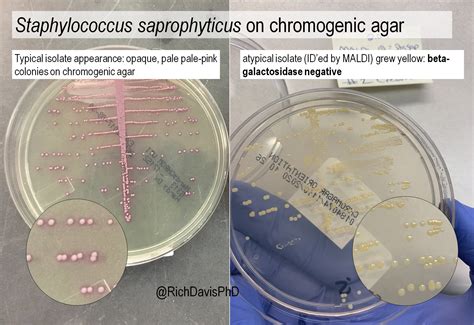 Staphylococcus Saprophyticus