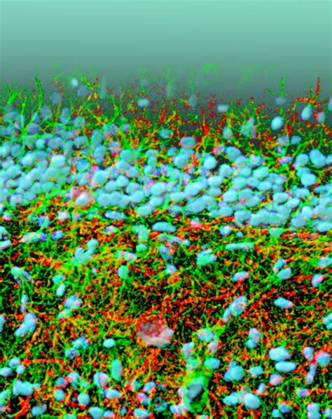 Spider Like Brain Cells May Be Active In Memory Making PBS News