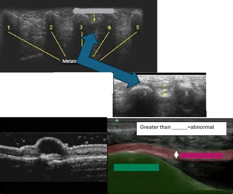 Msk Patho Diagram Quizlet