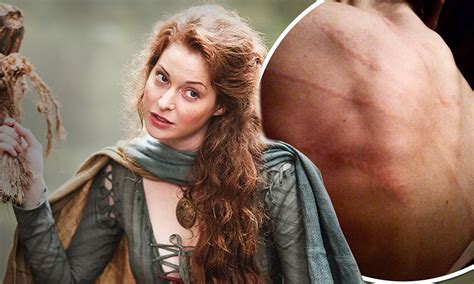 Game Of Thrones Actress Esmé Bianco 60 Photos Moonagedaydream Film