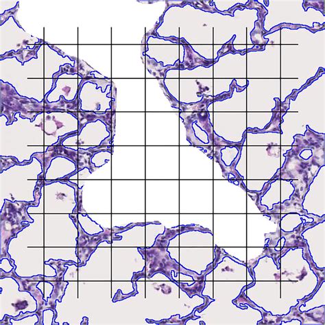 Illustration Of A Semi Automatically Segmented Lung Image With Download Scientific Diagram