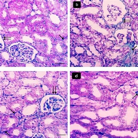 A Photomicrograph Of A Section In The Renal Cortex Of The Control Group Download Scientific