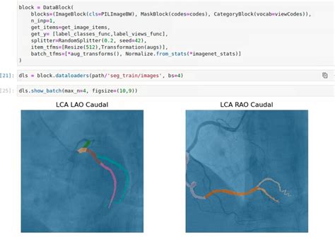 Specifying Nout Of Unetlearner For Multi Target Mask Category Prediction Fastai Fastai