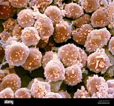 Archaea Coloured Scanning Electron Micrograph Sem Archaea Are A