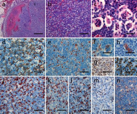 On Conventional He Staining A Lymph Node With Vanished Lymph Node
