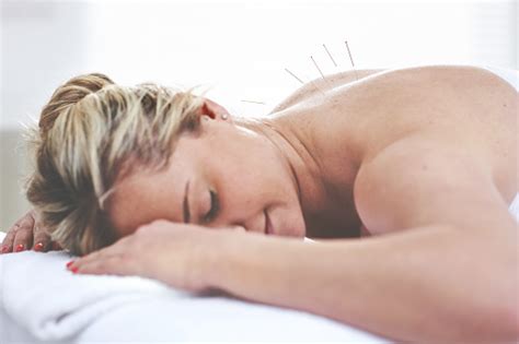 침술 세션 중에 바늘을 등에 삽입하는 한 청녀 치료를 위한 대체 요법을 받는 환자 모던 양식에 대한 스톡 사진 및 기타 이미지