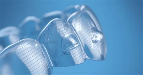 Invisalign Attachments What Are They And How Do They Work