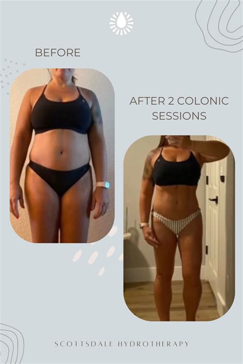 Benefits Of Colon Hydrotherapy Book A Session Today In 2025