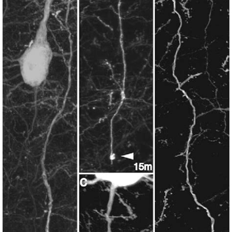 Diffuse Brain Injury Induces Rapid Secondary Axotomy Within Layer V Download Scientific Diagram
