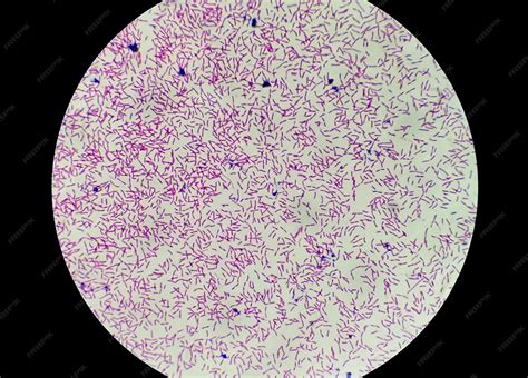 Premium Photo Microscopic View Of Gram Stain Showing Rod Shape