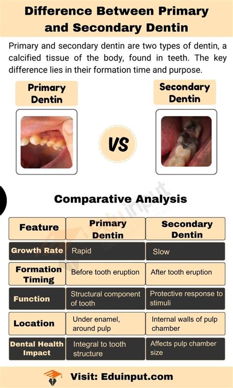 Difference Between Primary And Secondary Dentin In Teeth