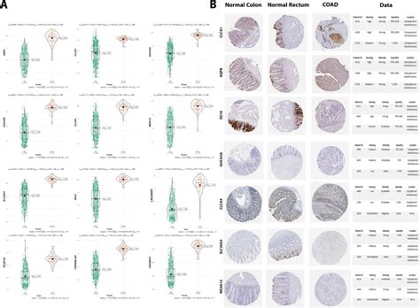 An Integrative Transcriptome Analysis Reveals Potential Predictive Prognostic Biomarkers And