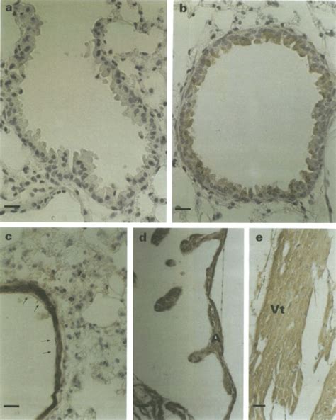 A Pulmonary Parenchyma And Bronchiolar Cells Were Completely Negative