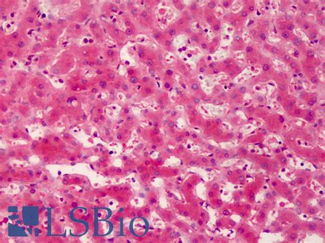 Ihc Plus™ Ddr2 Monoclonal Antibody Mouse Anti Human Lsbio