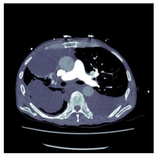 Medical Imaging In Fastai V Fastai Fast Ai Course Forums