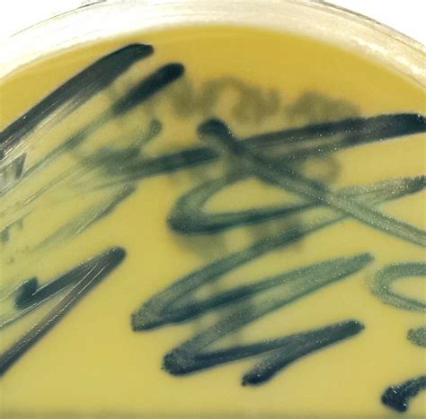 Note Medical Laboratory Facts Questions And Answers Facebook