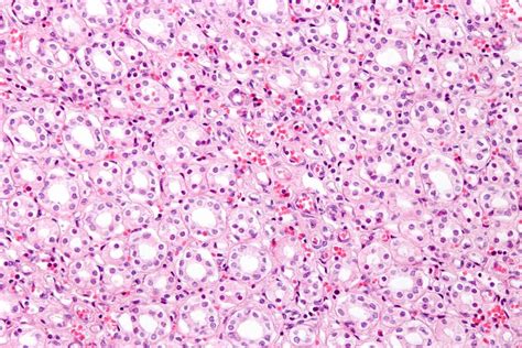 Donors Can Track How Science Uses Their Tissue But Stay Anonymous Hub