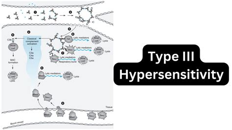 Types Of Hypersensitivity Download Scientific Diagram