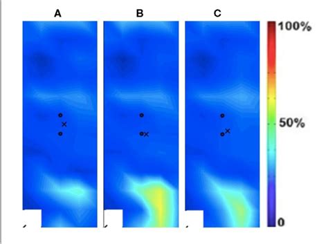 Figure 1 From High Density Electromyography Provides Improved Understanding Of Muscle Function