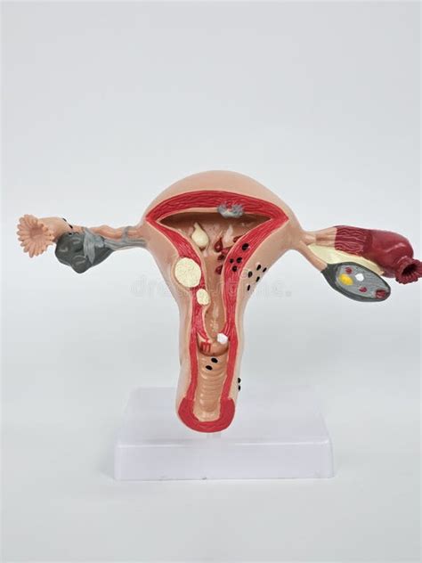 Detailed Anatomy Model Showcasing The Female Reproductive System With