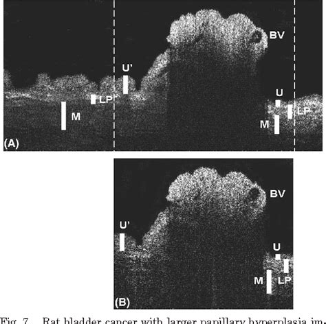 Figure 7 From Endoscopic Optical Coherence Tomography With A Modified