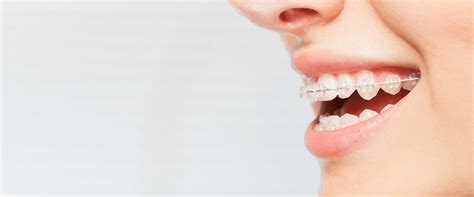 Swift Header Archformbyte Ltd