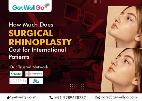 How Much Does Surgical Rhinoplasty Cost For International Patients
