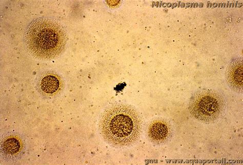 Mycoplasma Hominis Infection Mykoplasmen