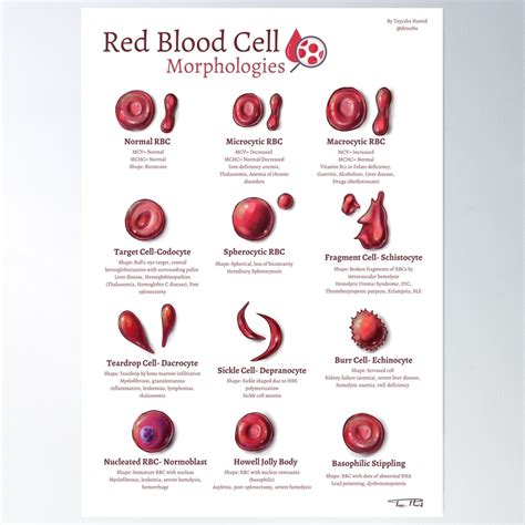 Rbc Morphologies Poster By Drteebu Types Of Blood Cells Diagram