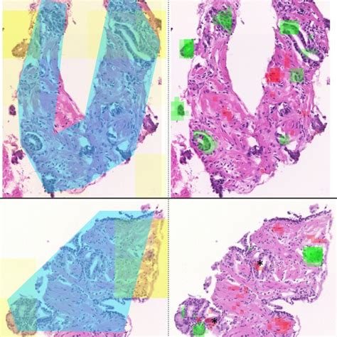 Examples Of Fn Misclassification Low Network Response Top Part Of Download Scientific