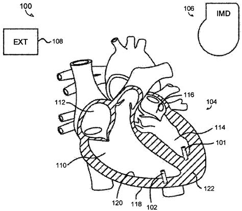 System Comprising A Pressure Sensor For Detecting Pressure And Body