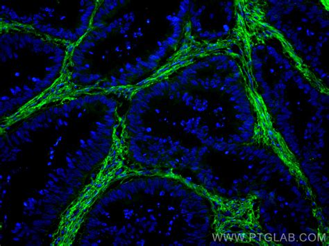 Fibronectin Antibody Cl488 66042 Proteintech