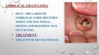 Minor Disorders Of Newborn Pptx