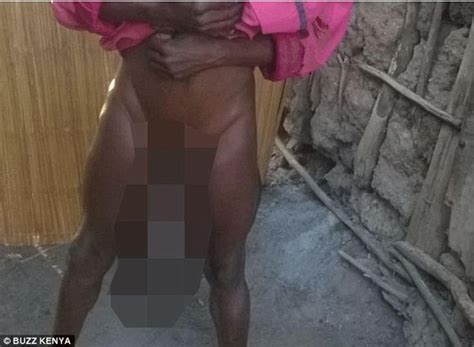 Kisah Sedih Pria Dengan Alat Kelamin Kali Lebih Besar Lifestyle Fimela Com