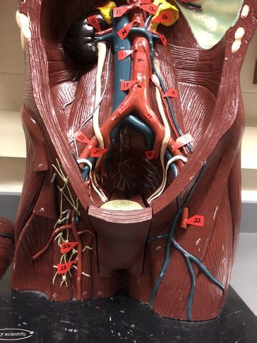 Common Iliac Flashcards Quizlet