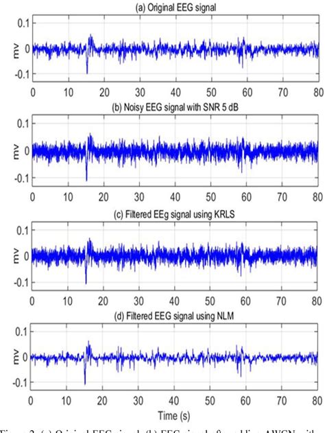 figure 2 from investigation of eeg noise and artifact removal by patch