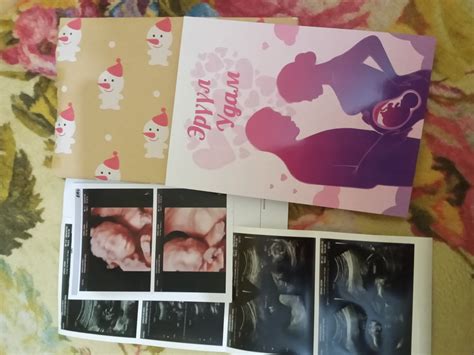 Жирэмсний 16 долоо хоногтойгоос ураг орчмын шингэний гол эх үүсвэр нь