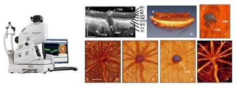 Topcon 3d Oct 2000 W Digital Non Mydriatic Retinal Camera And Oct Download Scientific Diagram