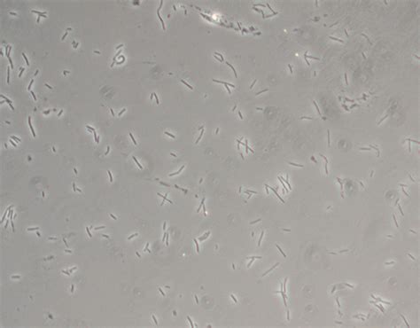 How To View Bacteria Under The Microscope Tips Tricks And The Best Microscopes