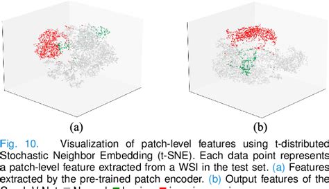 Figure 10 From A Hierarchical Graph V Net With Semi Supervised Pre