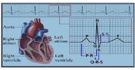 Figure 1 From Advanced Wavelet Transform Techniques For Ecg Feature Extraction Semantic Scholar