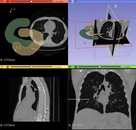 Show Slice Edges In 3d View Feature Requests 3d Slicer Community
