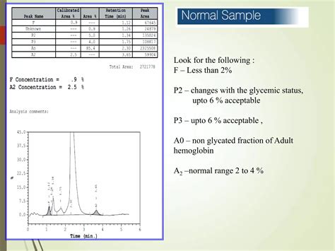 Hplc Interpretation Ppt