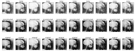 GitHub Sm Zw Noise Removal From Medical Images In This Repository Denoising Of Medical