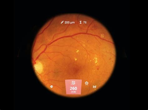 Visulas Green Carl Zeiss Ag Produkt