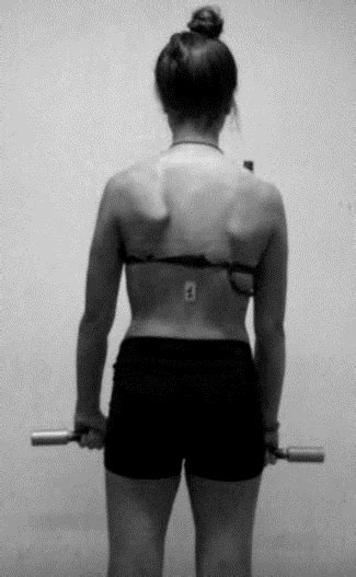 Scapular Dyskinesis Test Download Scientific Diagram
